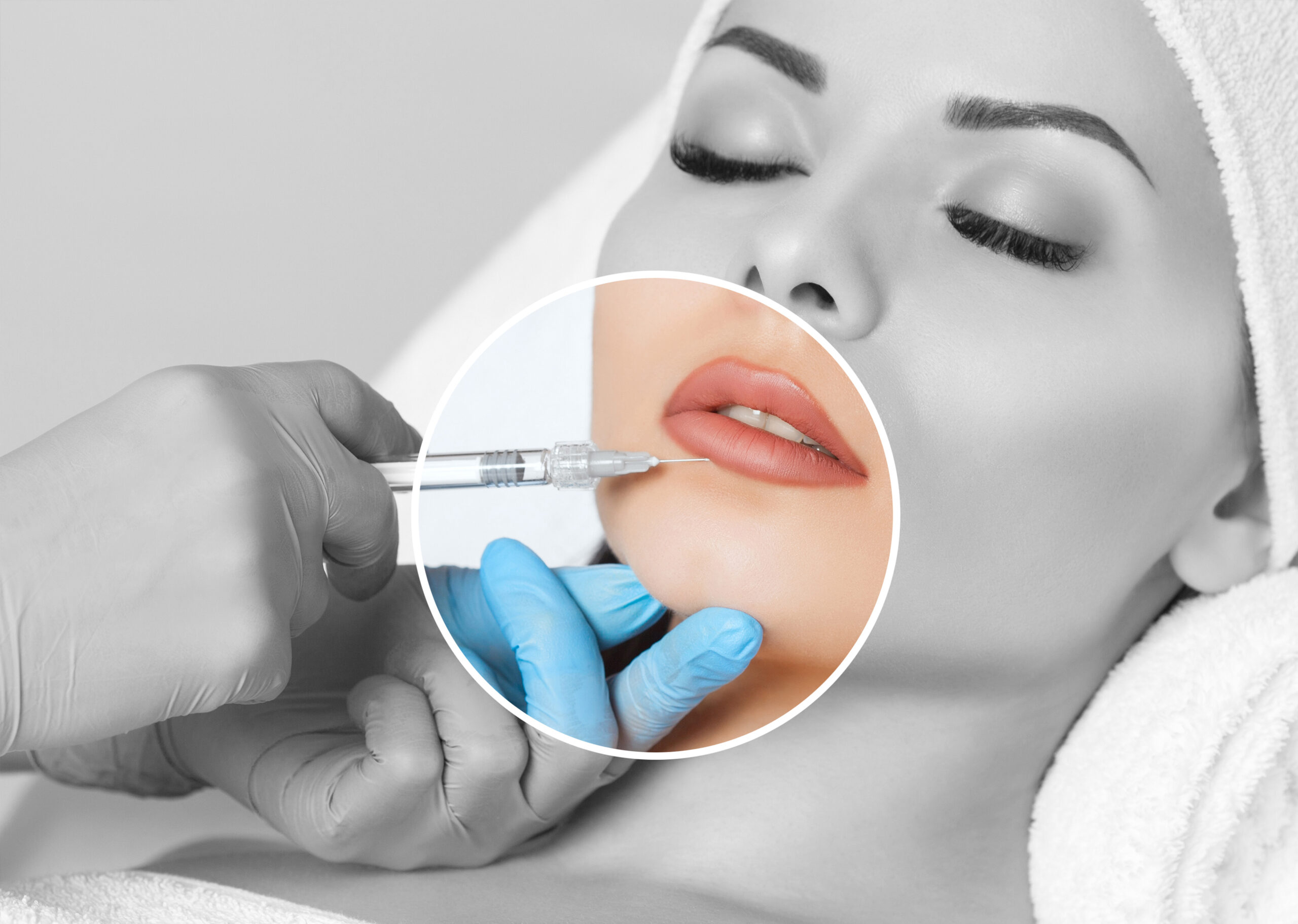 Dermal Fillers - Dr Sultana Clinic
